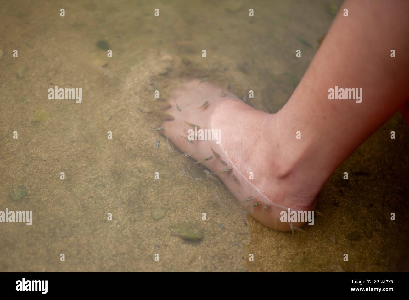 Fish nibbling feet hi-res stock photography and images - Alamy