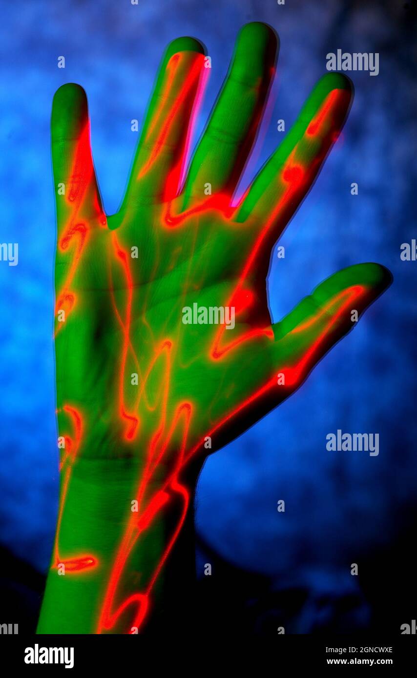 Hand x ray blood hi-res stock photography and images - Alamy