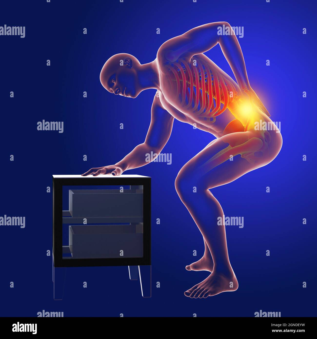 Back pain, illustration Stock Photo - Alamy