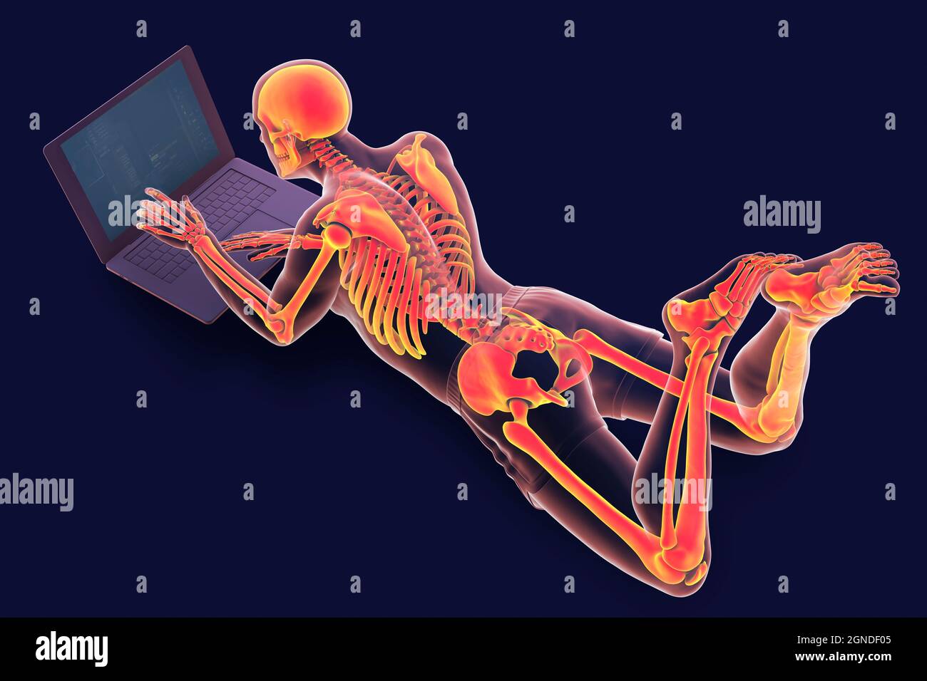 Bad posture whilst using laptop, illustration Stock Photo - Alamy