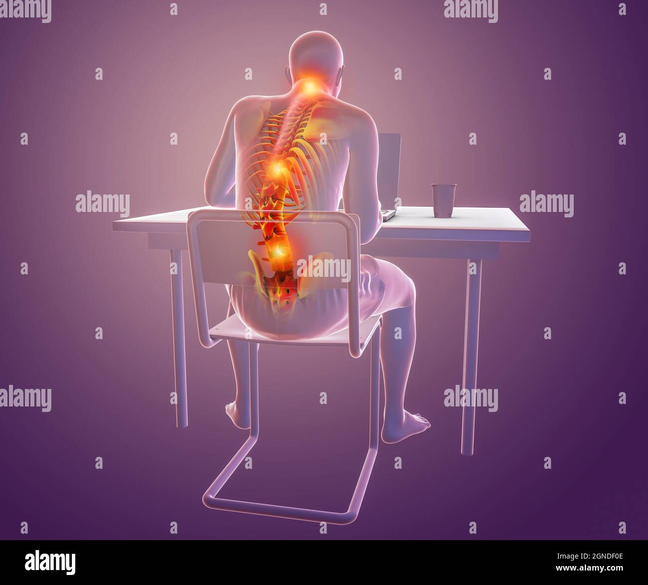 Bad posture whilst using laptop, illustration Stock Photo - Alamy