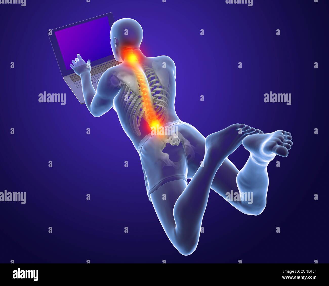 Improper bad posture hi-res stock photography and images - Alamy