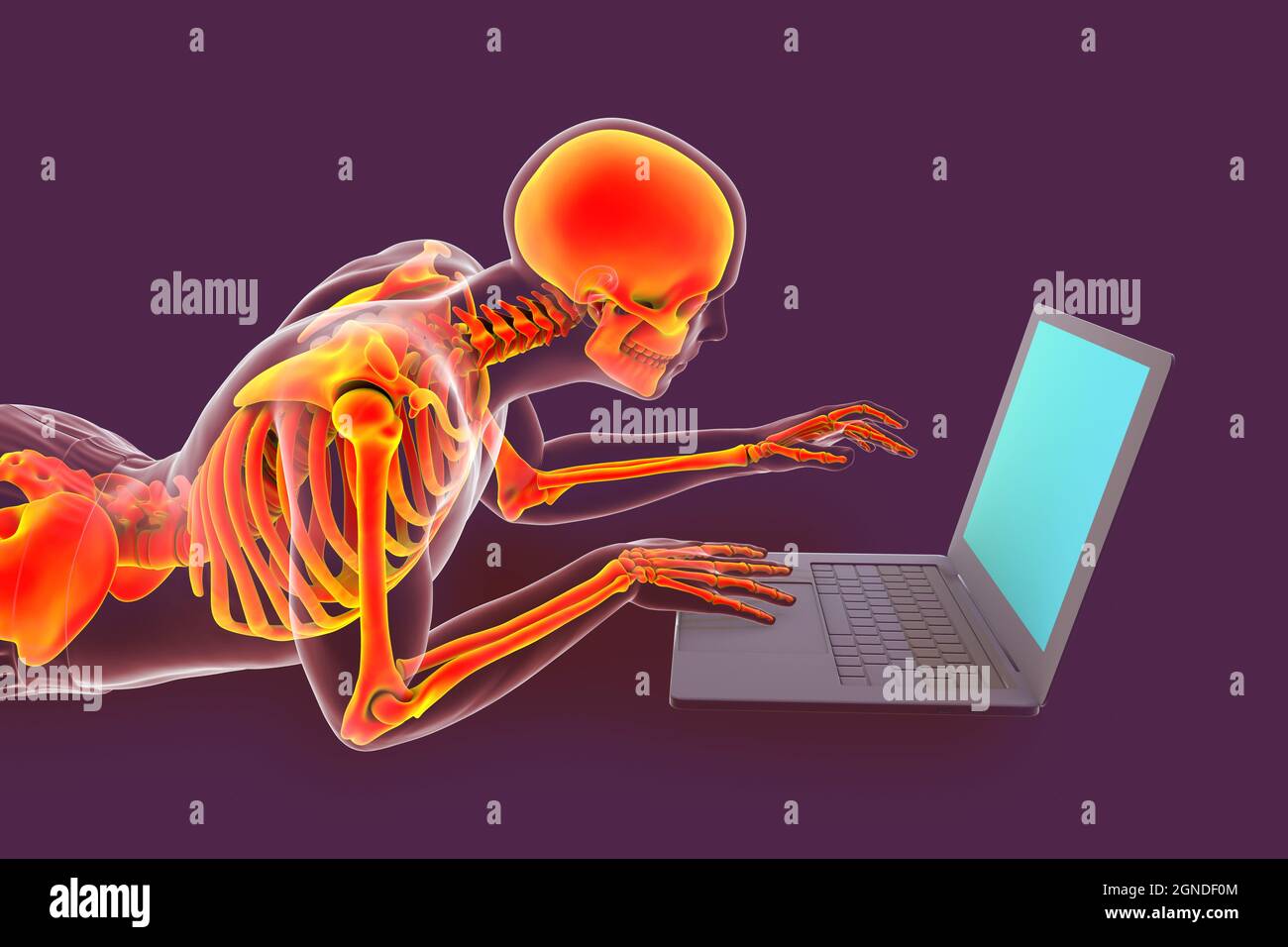 Bad posture whilst using laptop, illustration Stock Photo - Alamy