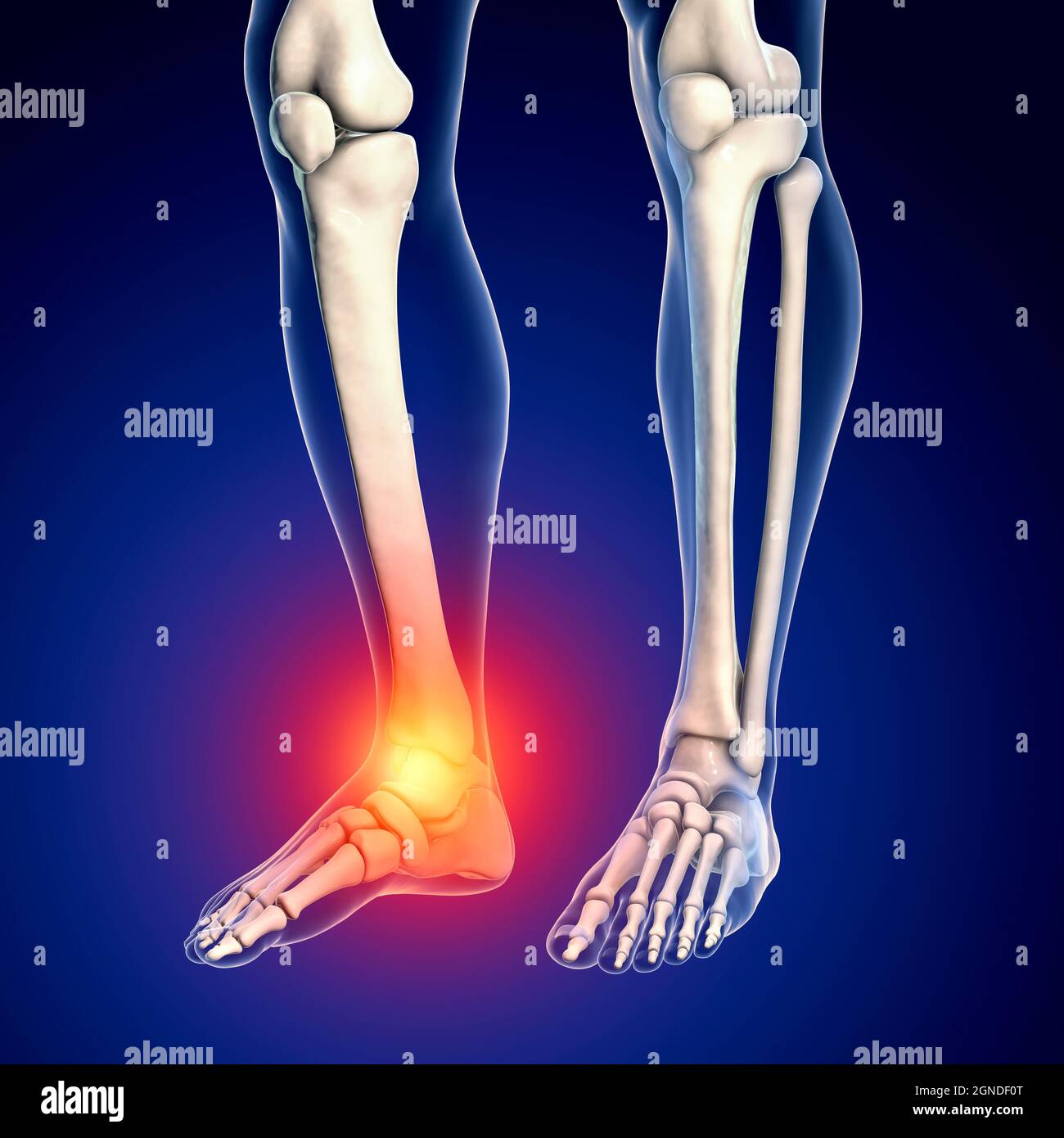 Painful ankle, illustration Stock Photo - Alamy