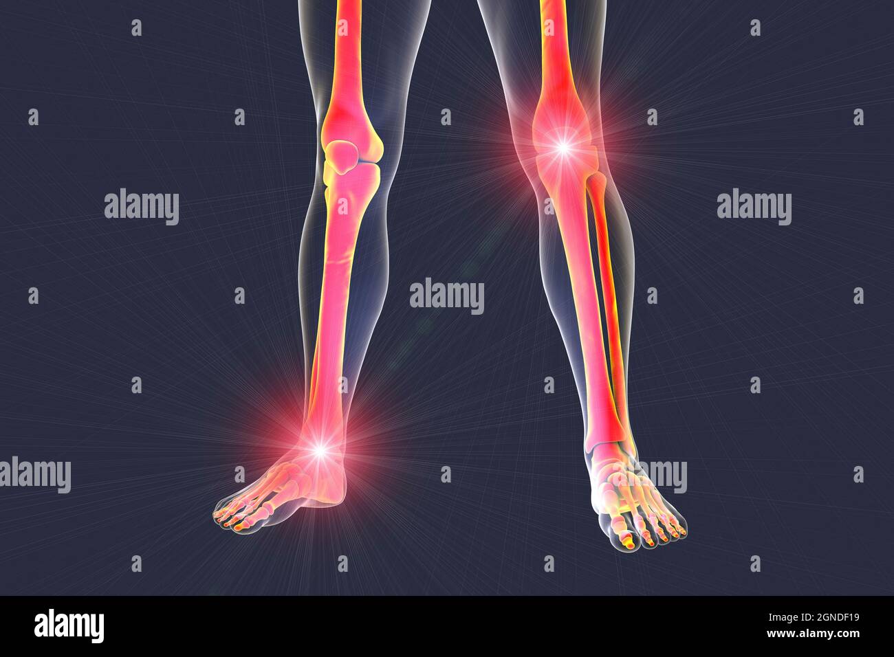 Transparent arthritis hi-res stock photography and images - Alamy