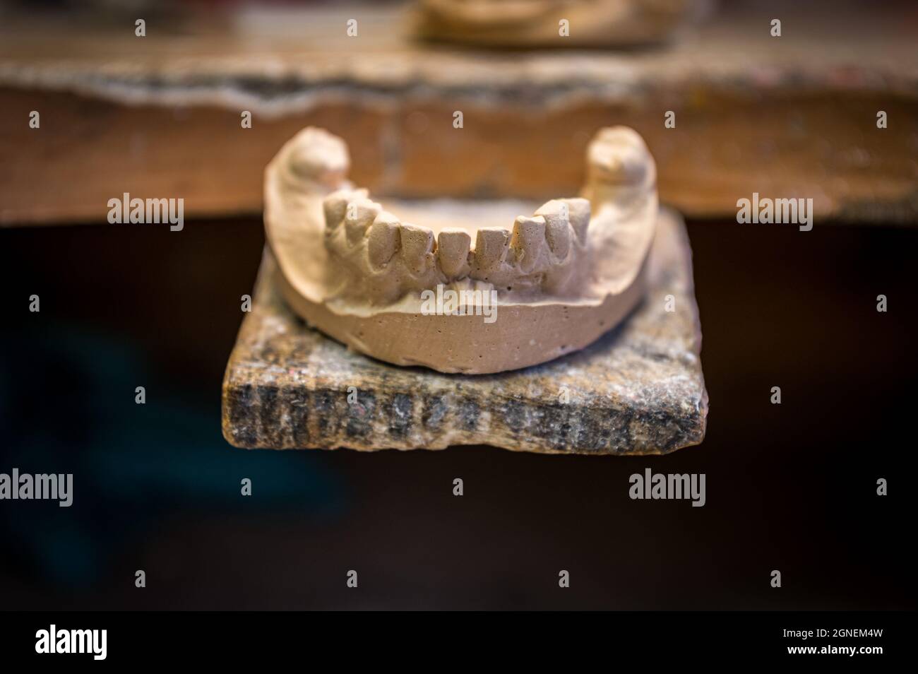 a copy of a person's teeth with a dental technician in the process of ...