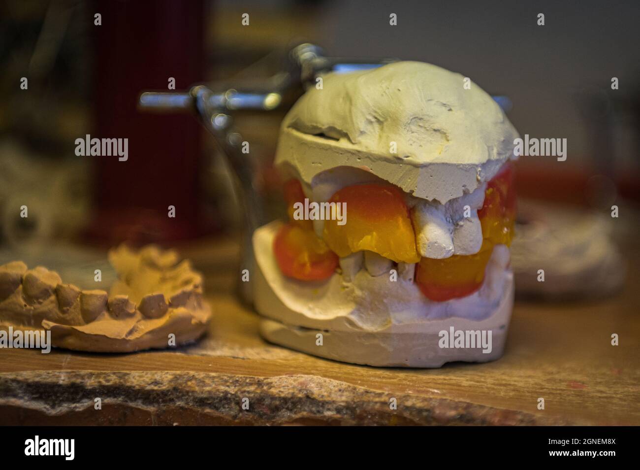 a copy of a person's teeth with a dental technician in the process of ...