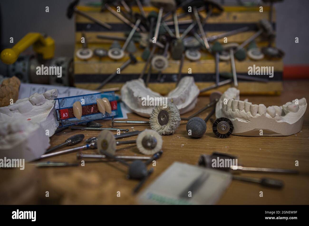 a copy of a human tooth cast in plaster stands on the table of a ...