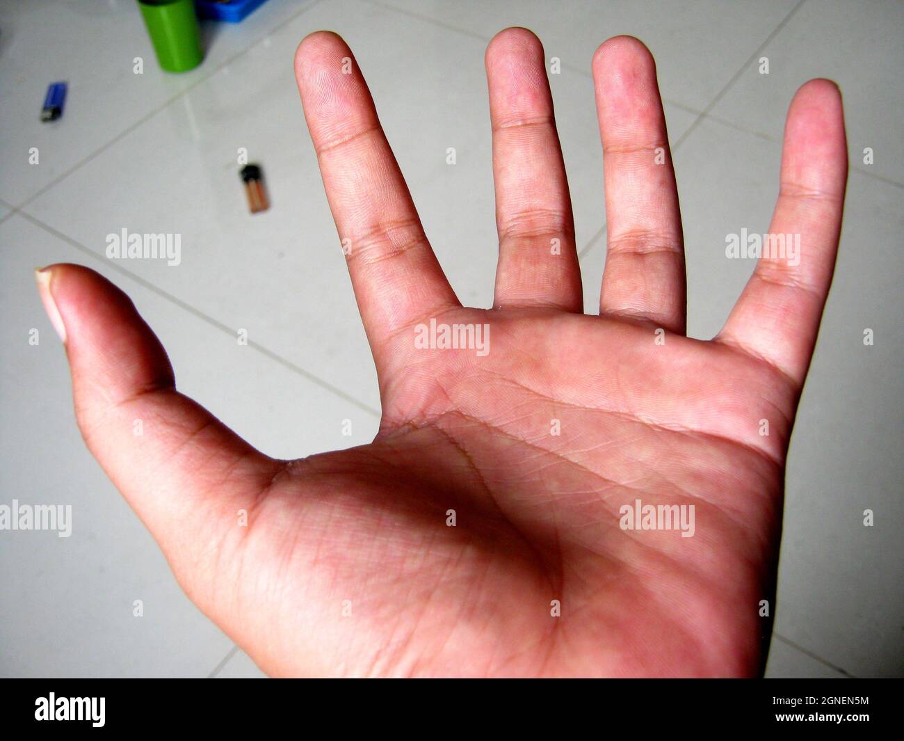 Finger anatomy hi-res stock photography and images - Alamy