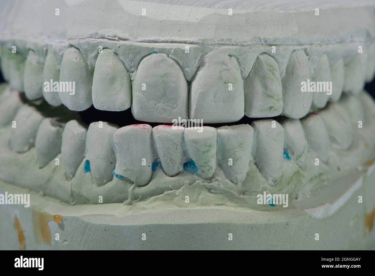 Gypsum Dental model of human teeth. Close up Stock Photo - Alamy