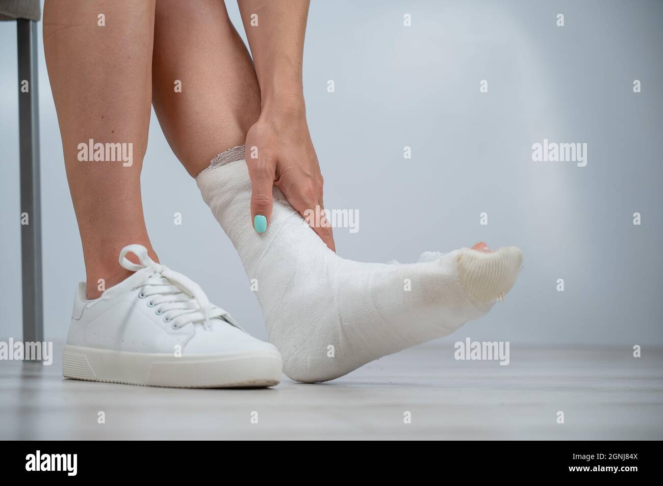 Close-up of female legs with plaster cast. A woman with a broken leg ...