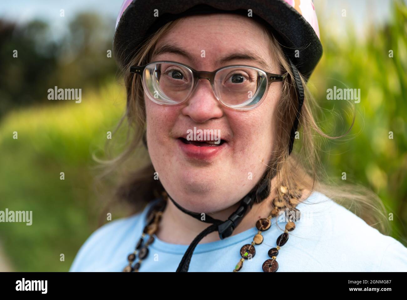 Portrait Of A 39 Year Old Woman With The Down Syndrome Happy And Portrait Of A 39 Year Old Woman With The Down Syndrome Happy And