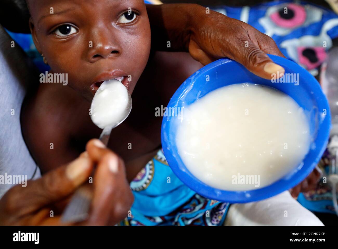 African hospital. Paediatric unit. Meal. Benin Stock Photo - Alamy