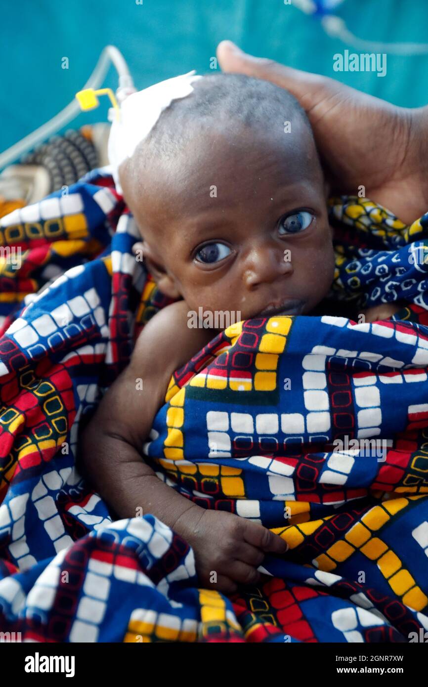 African hospital. Pediatric ward. Child in intensive care unit. Benin ...