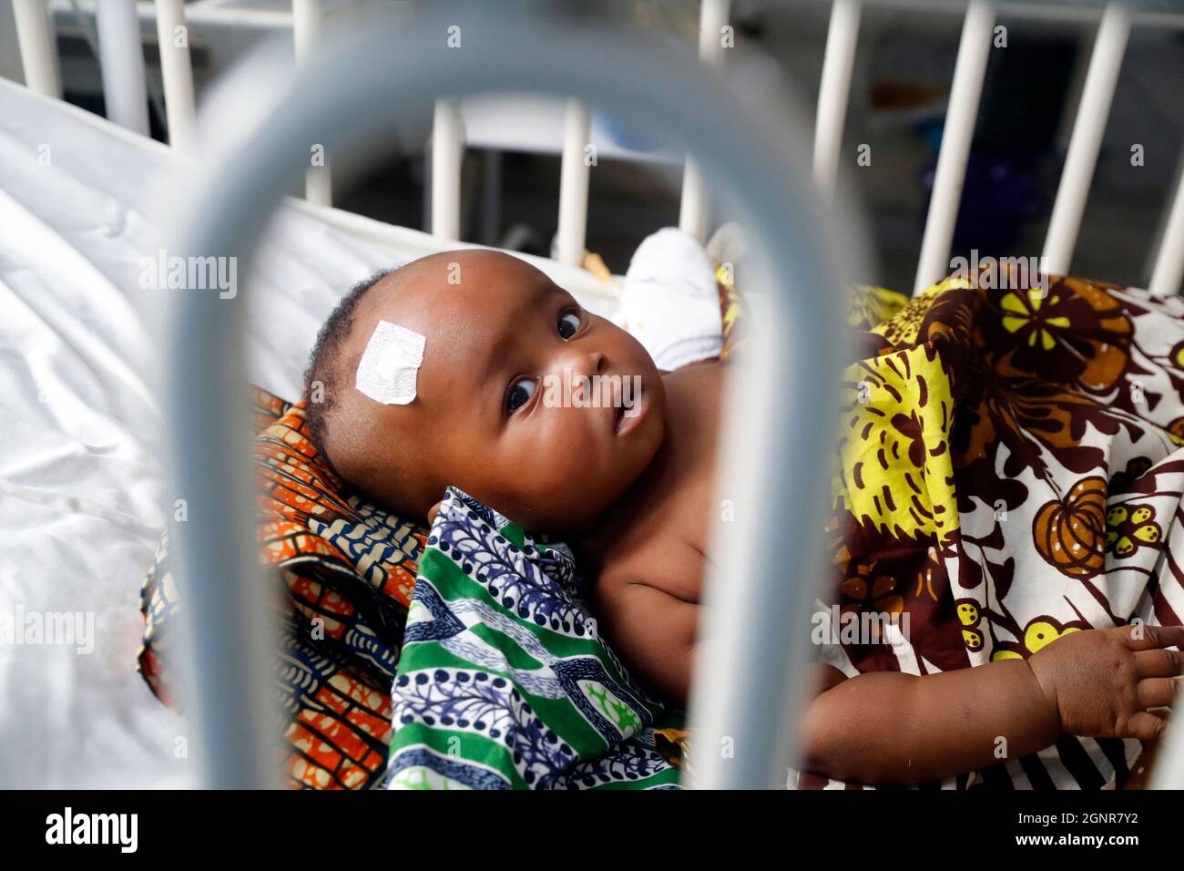African hospital. Pediatric ward. Child in intensive care unit. Benin ...