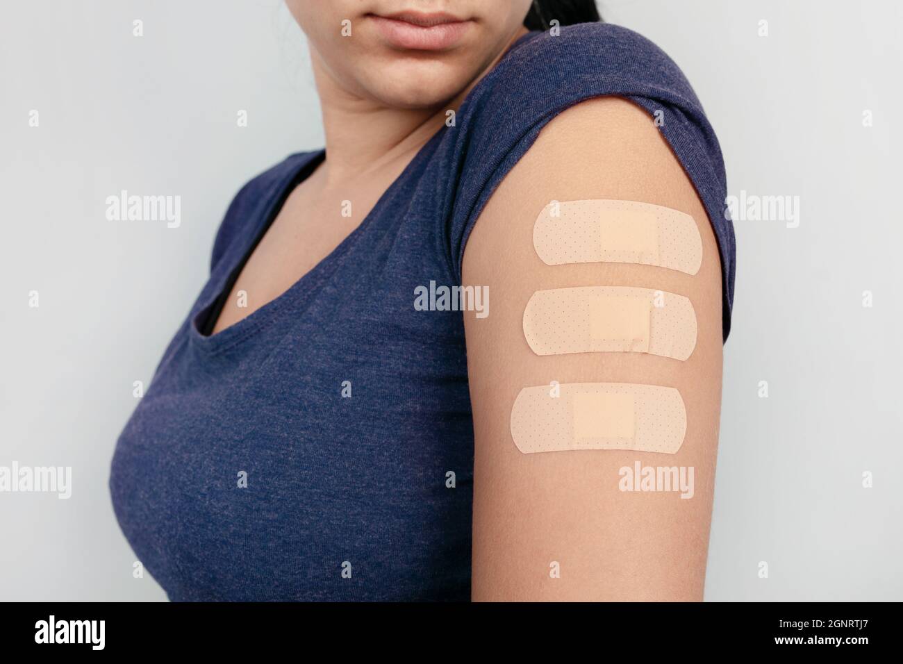 woman showing many plasters on arm after coronavirus vaccine, new ...