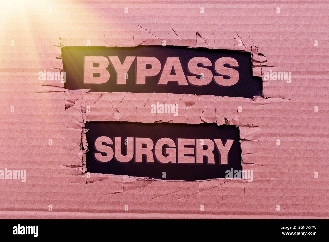 Hand writing sign Bypass Surgery. Word Written on type of surgery that ...