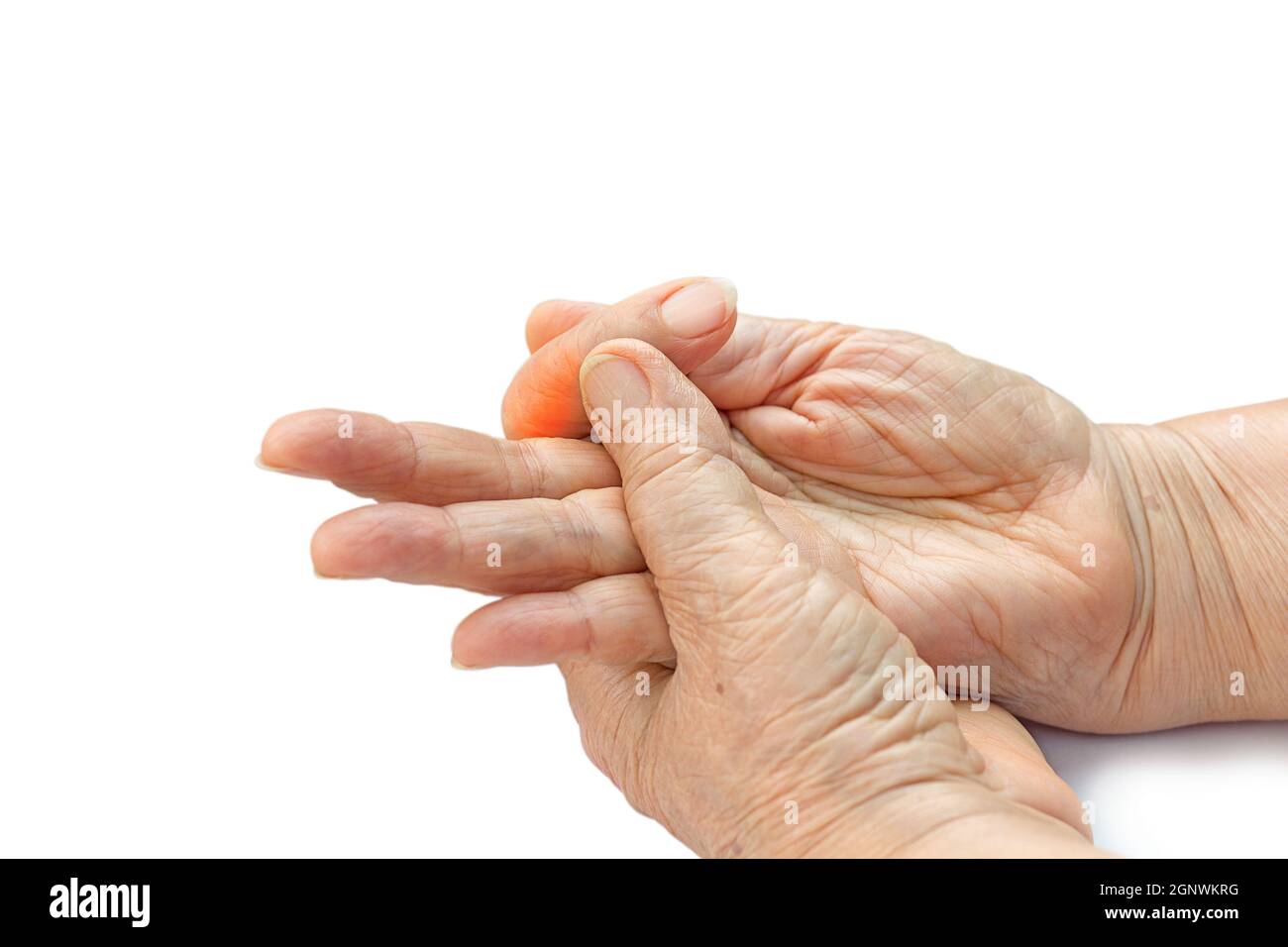 Painful finger joints hi-res stock photography and images - Alamy
