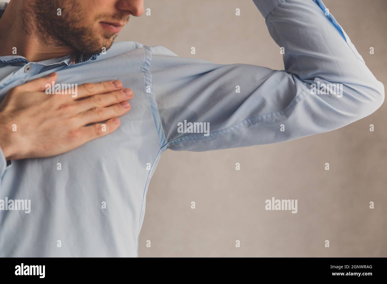 Man with hyperhidrosis sweating very badly under armpit in blue shirt ...