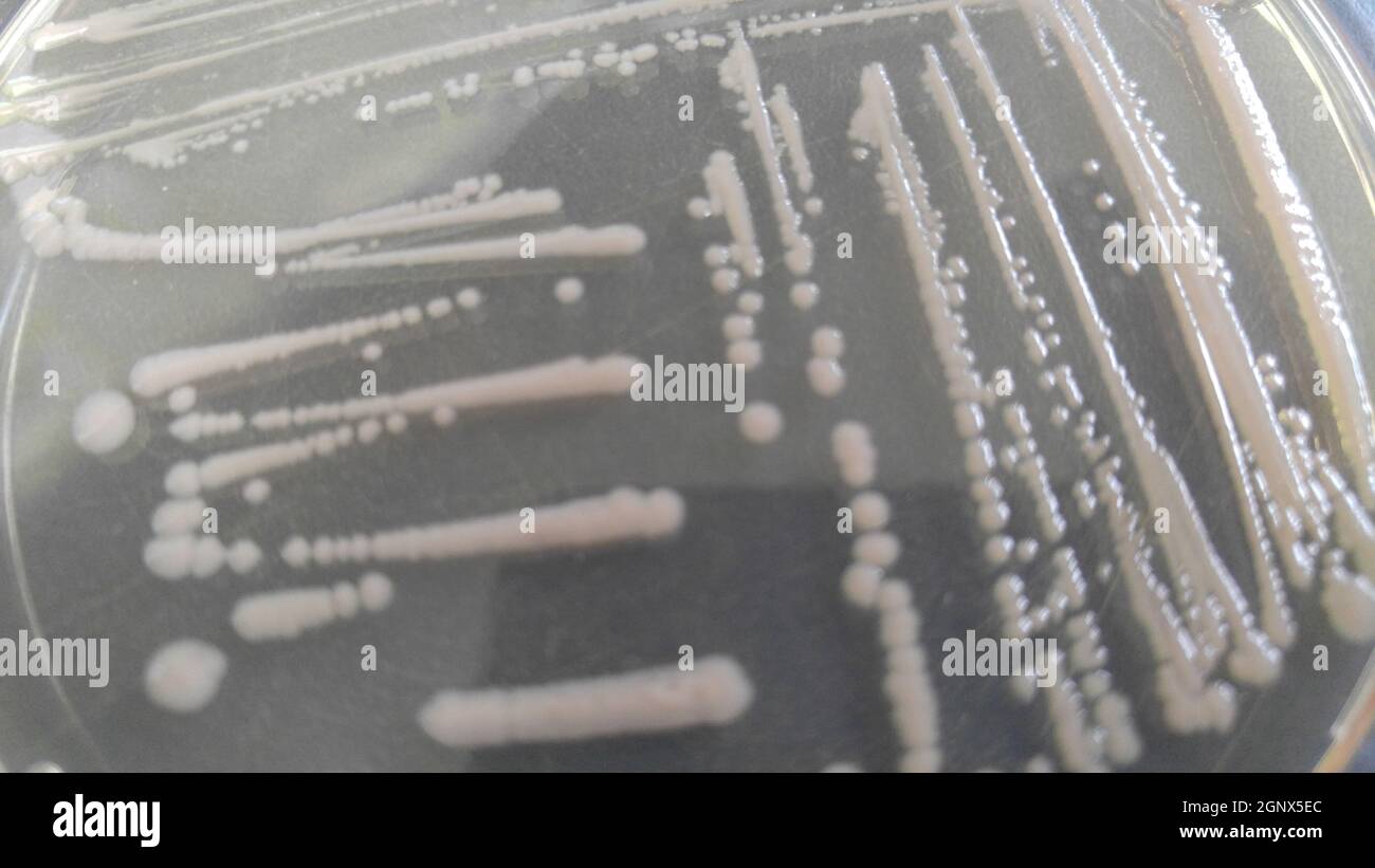 Bacteria colonies on agar hi-res stock photography and images - Alamy