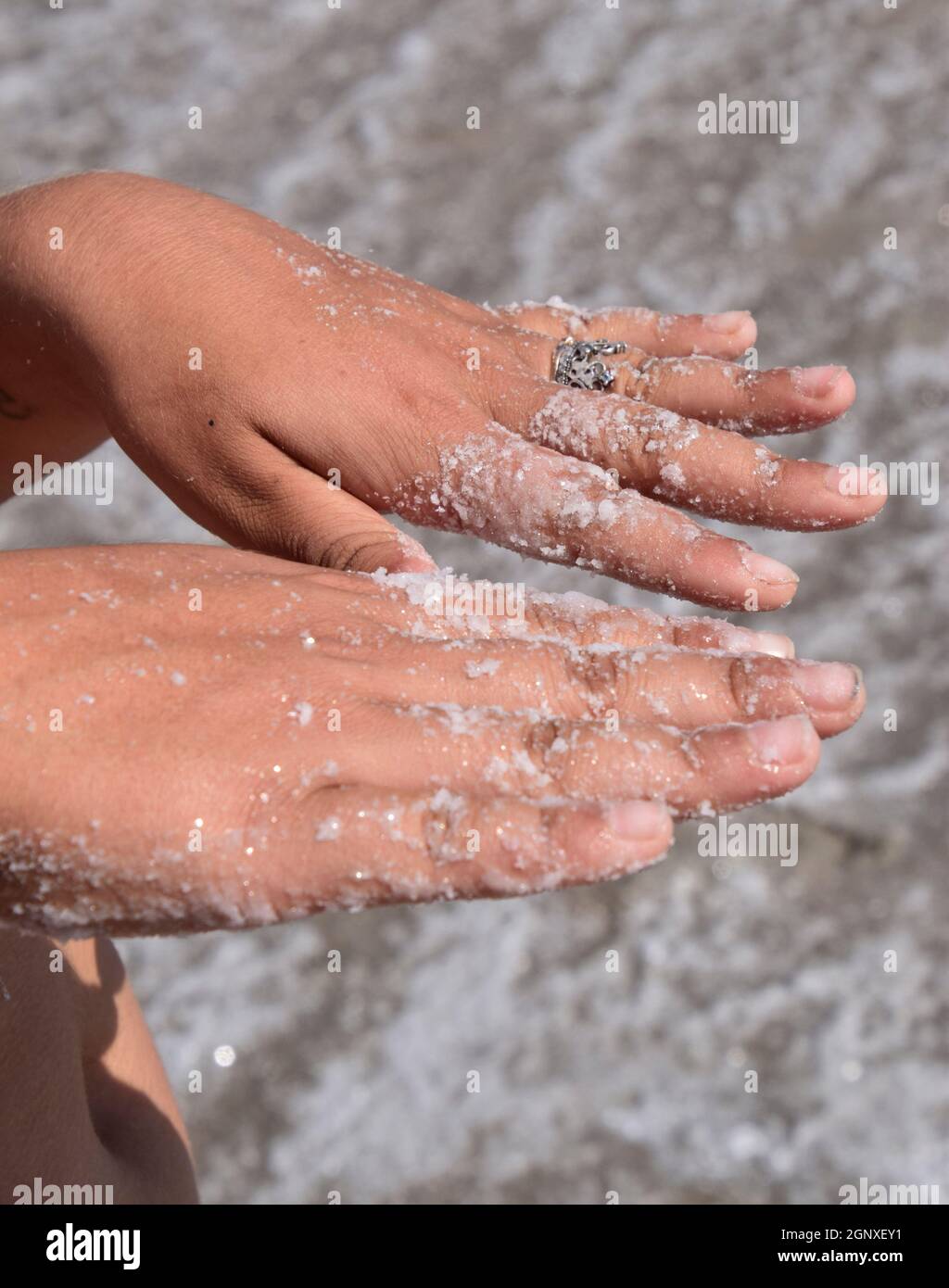 Salt on the girl's hands. Dried salt on the hands of women of the ...