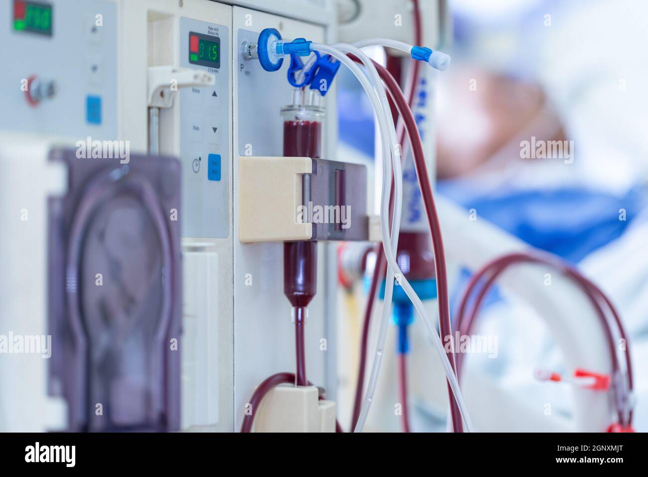 Dialysis machine is working. Acting as a substitute for the kidneys to ...