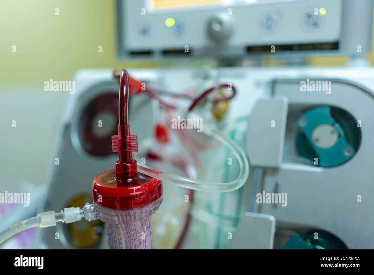 The specialist are checking continuous renal replacement therapy ...