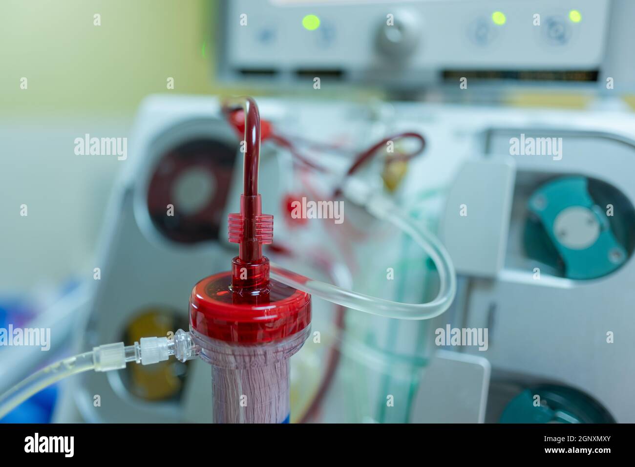 The specialist are checking continuous renal replacement therapy ...