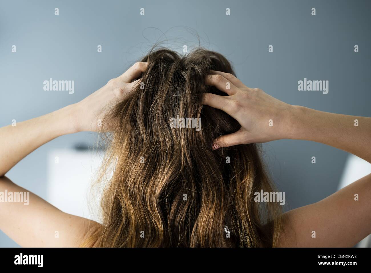 Dry scalp hi-res stock photography and images - Alamy