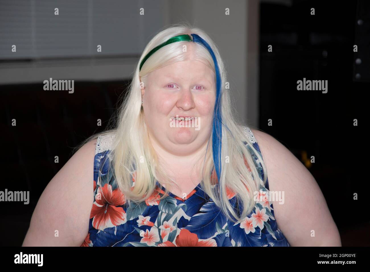 Albino woman wearing green and blue streaks in her hair Stock Photo - Alamy