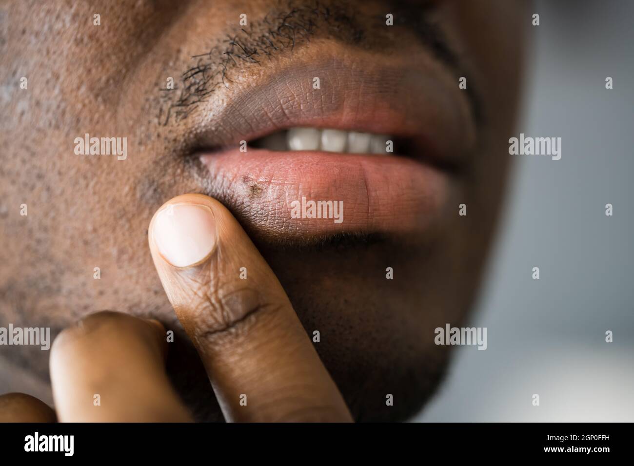 African American Mouth