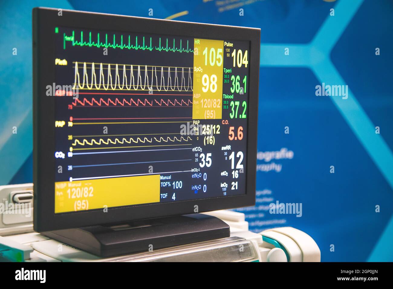Cardiogram monitor hi-res stock photography and images - Alamy