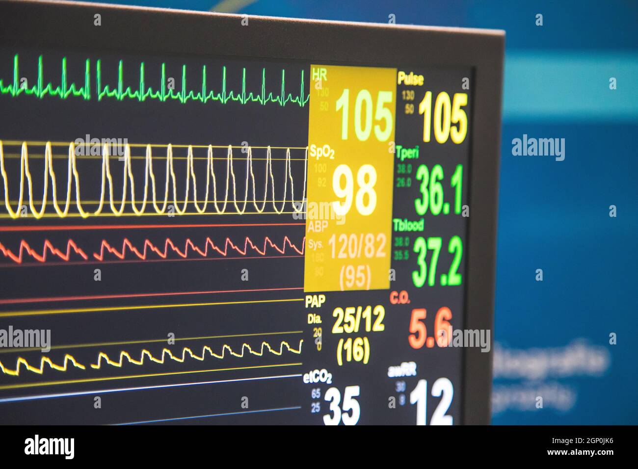 Cardiogram monitor hi-res stock photography and images - Alamy