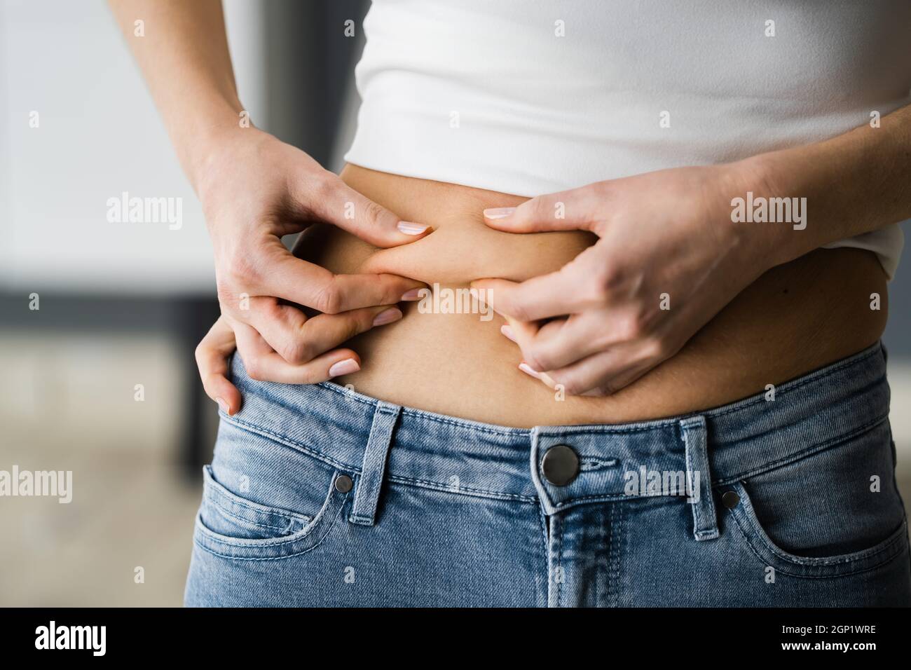 Stomach Fat Liposuction And Diet. Stomach Skin Pinch Stock Photo - Alamy