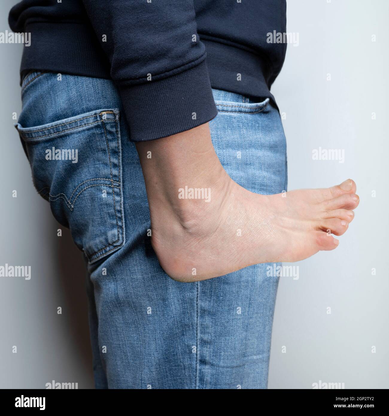 a man with a foot instead of a hand Stock Photo - Alamy