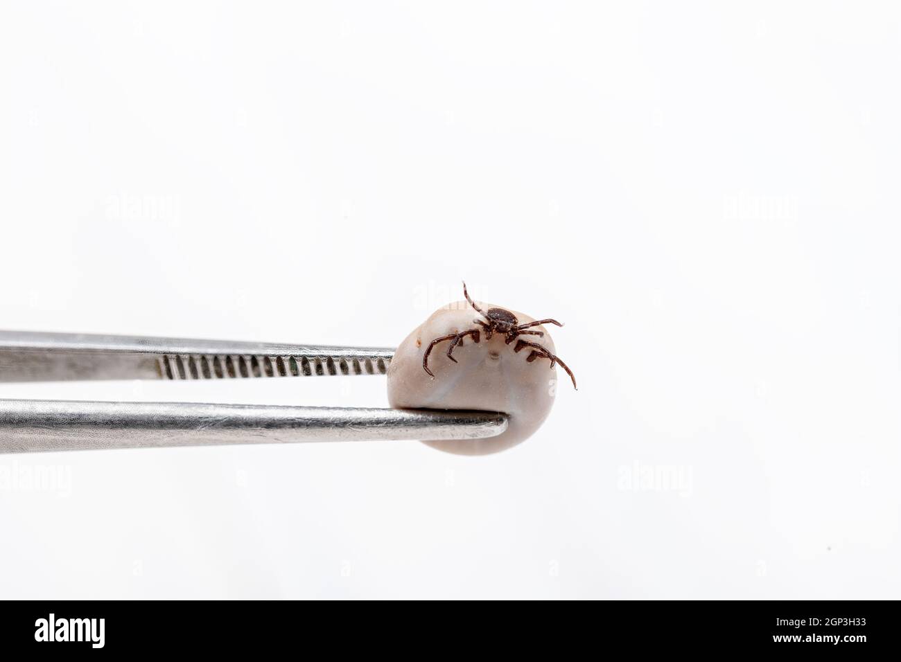 Tick (Ixodes ricinus) filled with blood in tweezers isolated on white ...