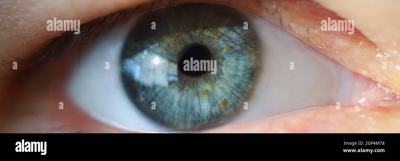 Male pupil is blue with overhanging eyelid Stock Photo - Alamy