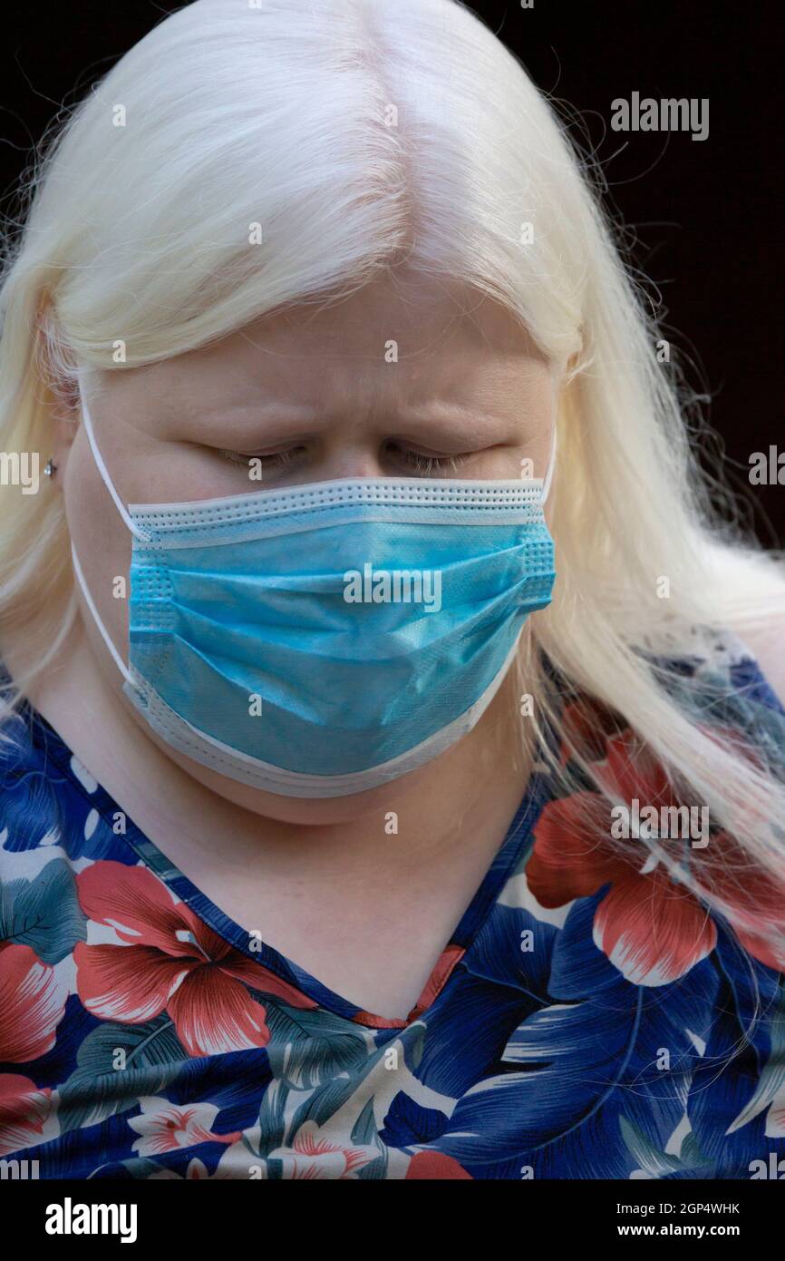 Albino face close up hi-res stock photography and images - Alamy