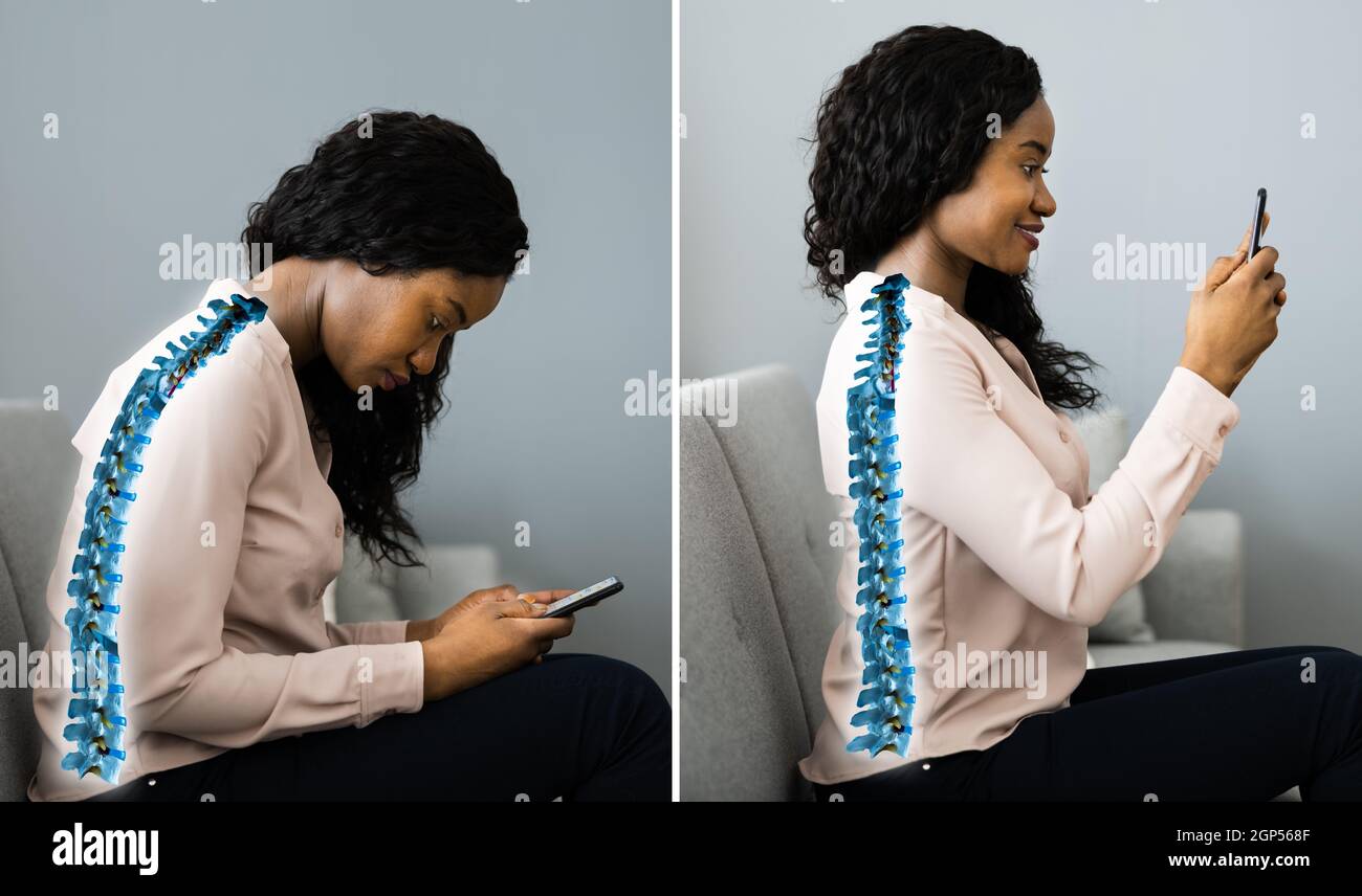Incorrect And Correct Spine Posture Using Smartphone Or Phone Stock ...