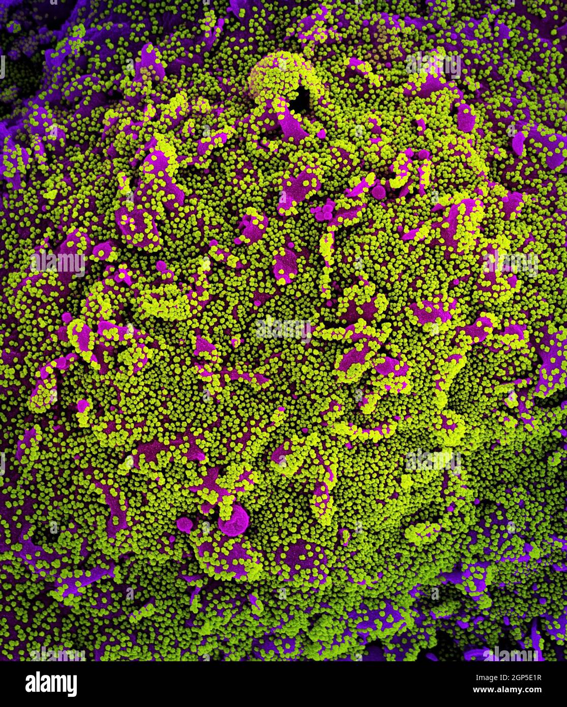 Novel Coronavirus SARS-CoV-2. NIAID colorized scanning electron ...