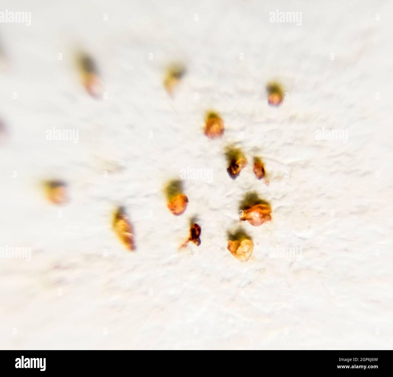 Parasitic Worms In Skin