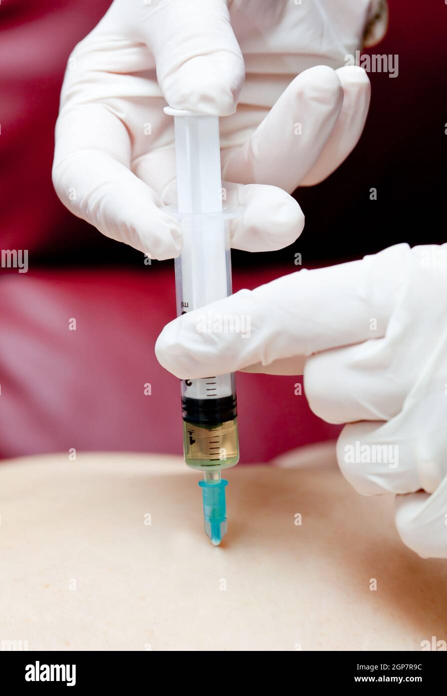 Injection syringe with medicine on the buttock Stock Photo - Alamy