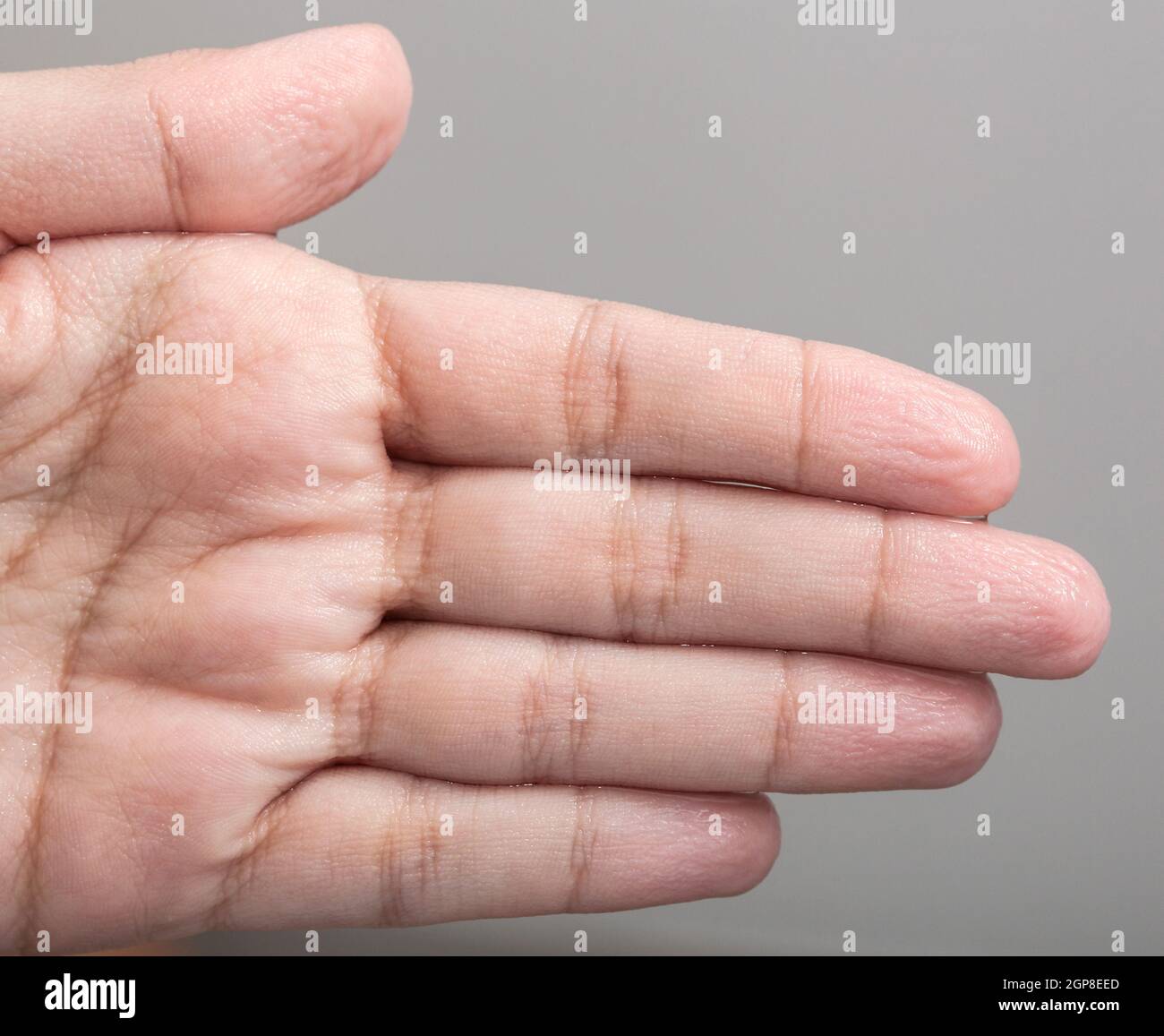 Wrinkled skin of the hands because of long time in water Stock Photo ...