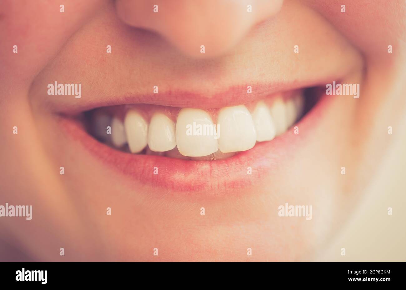 Healthy white teeth of a young woman, close up picture Stock Photo - Alamy