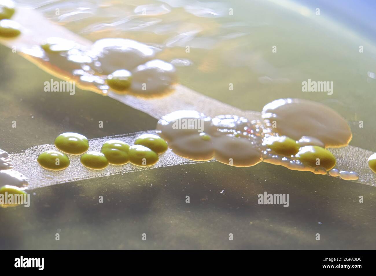 Staphylococcus aureus agar plate hi-res stock photography and images ...