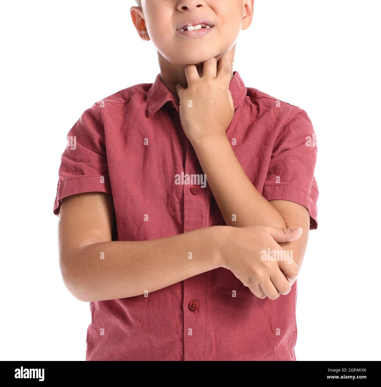 Heat rash child hi-res stock photography and images - Alamy