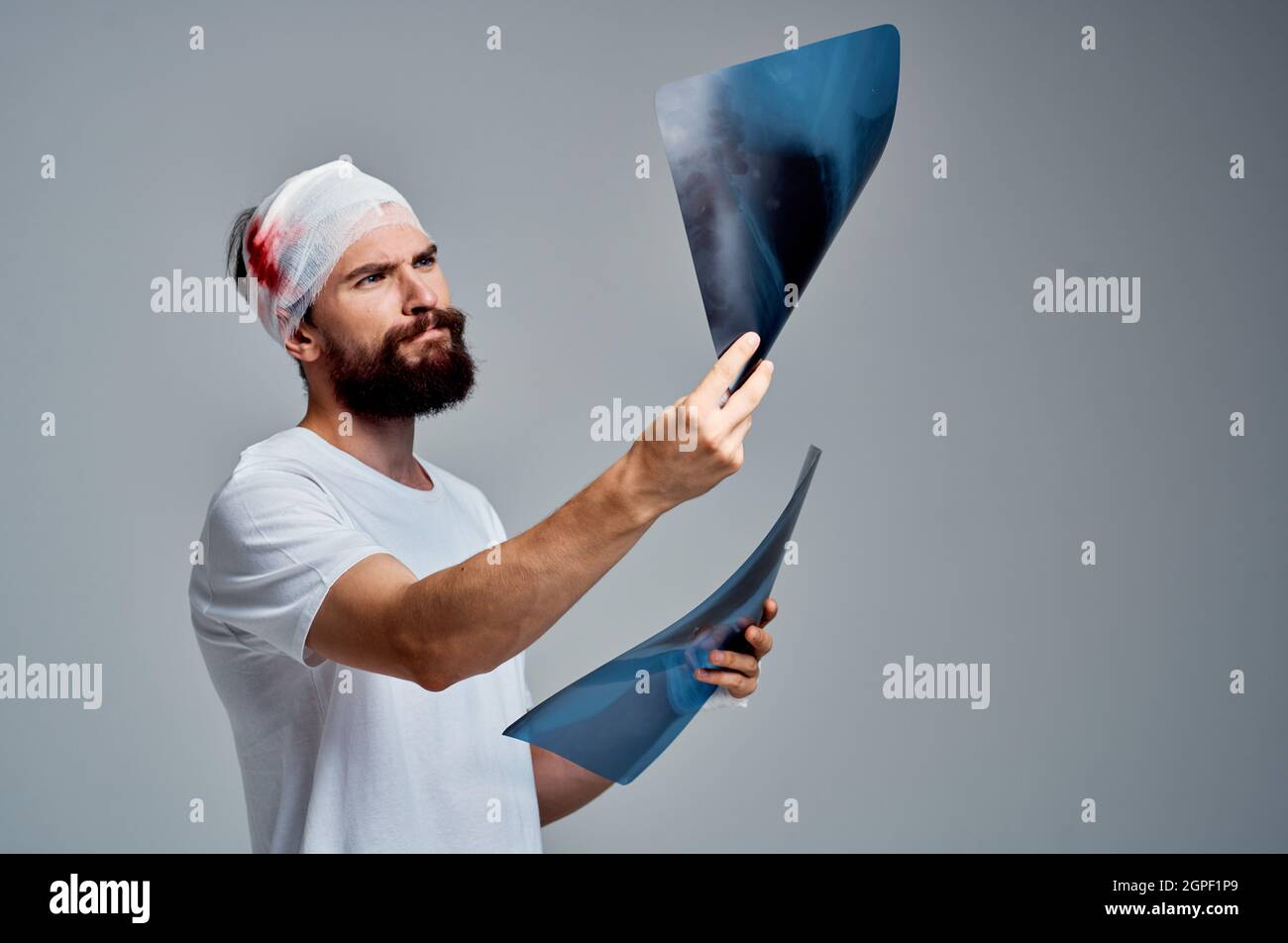 a patient head injury radiology treatment health care Stock Photo - Alamy