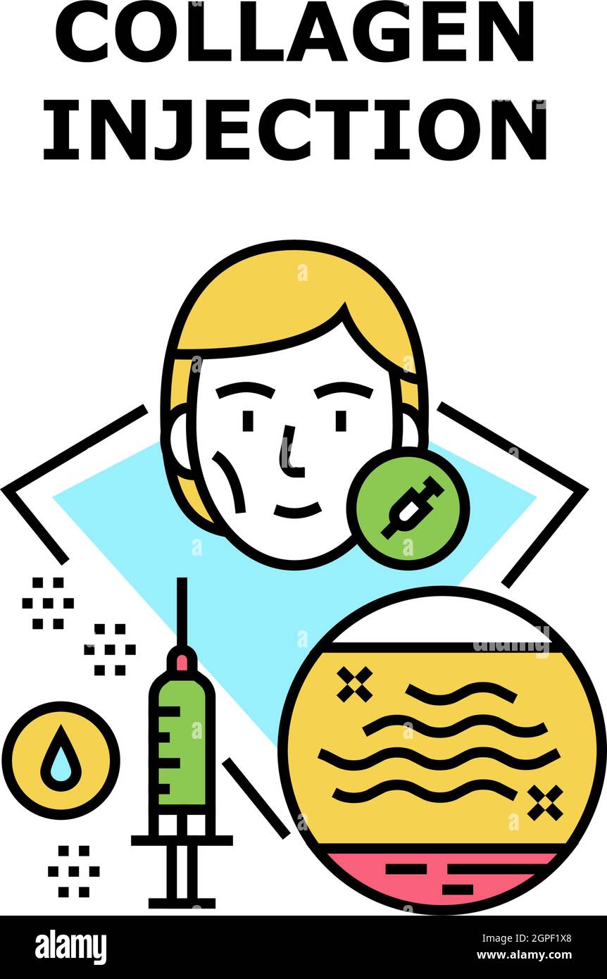 Collagen Injection Concept Color Illustration Stock Vector Image & Art ...