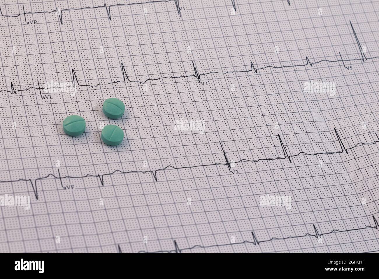 Heart waves recorded on paper called an electrocardiogram. Heart beat ...