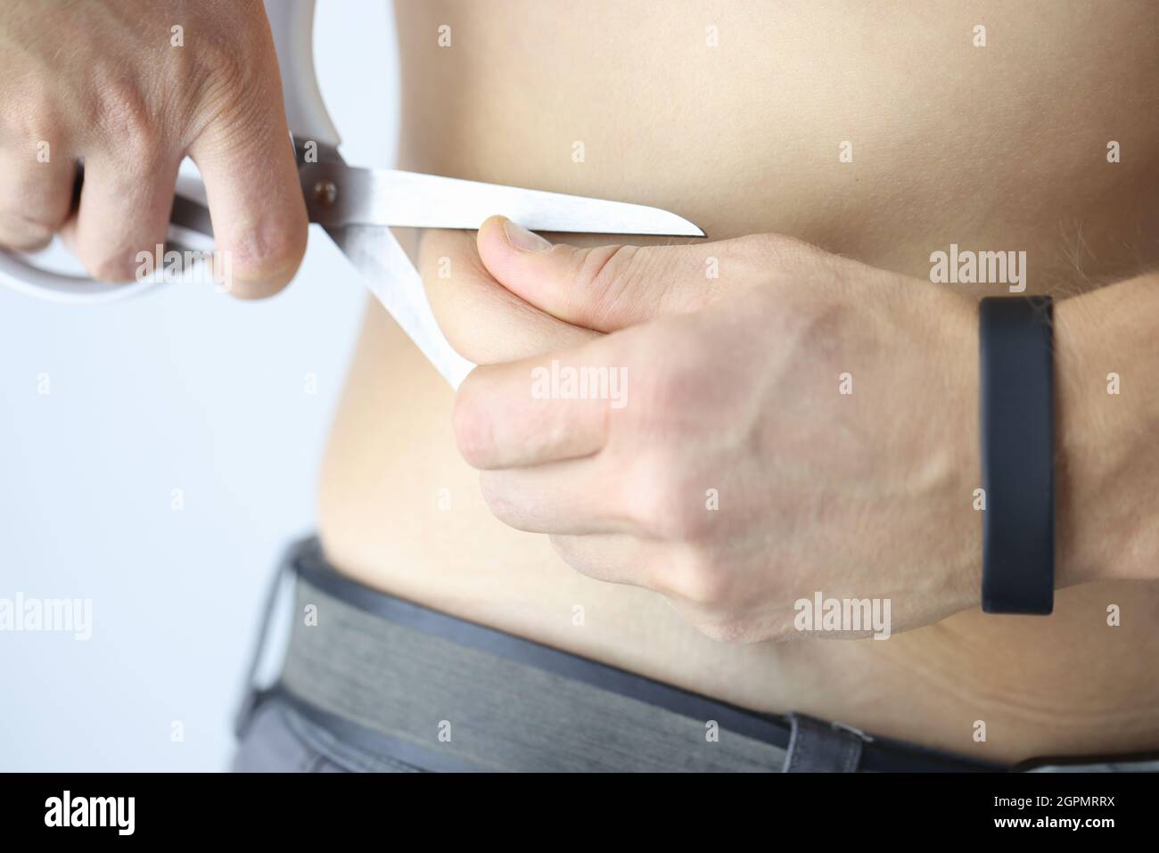 Man cuts off excess skin with fat from abdomen with scissors Stock ...